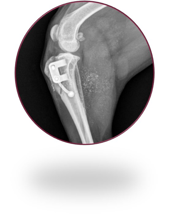 DELOS Medical GmbH - SPP System